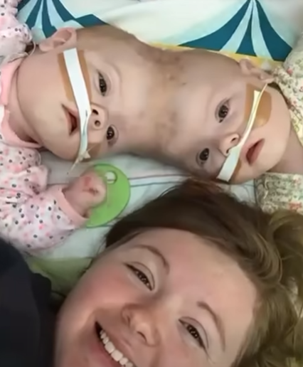 Conjoined Twins Abby and Erin Delaney Celebrate Kindergarten Graduation ...